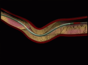 Home - Midwest Vascular Institute